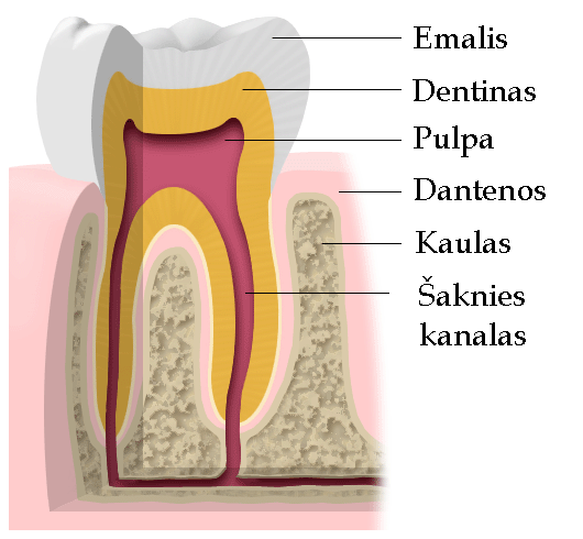 Danties skausmas ir jo priežastys | Endodontija